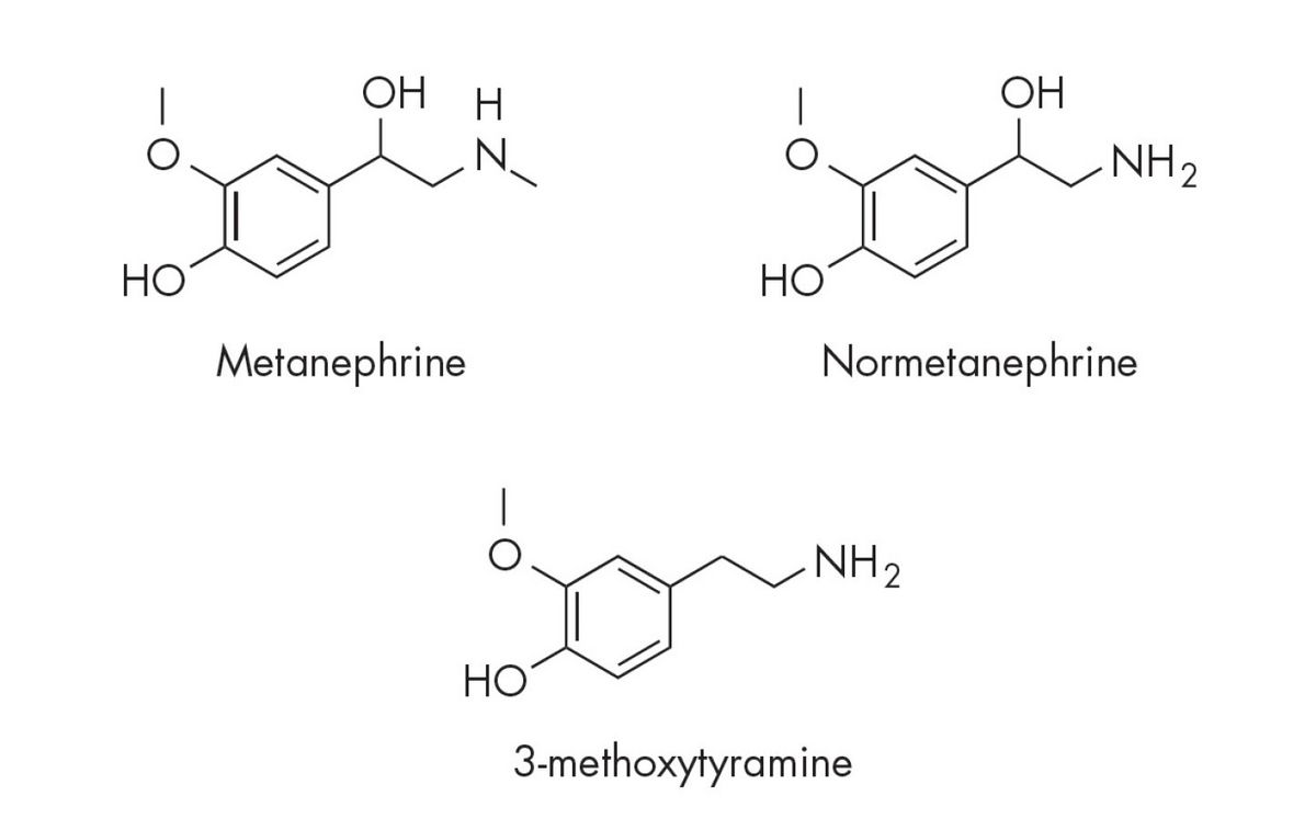 Freie Metanephrine in Plasma - Zentrum für Labormedizin